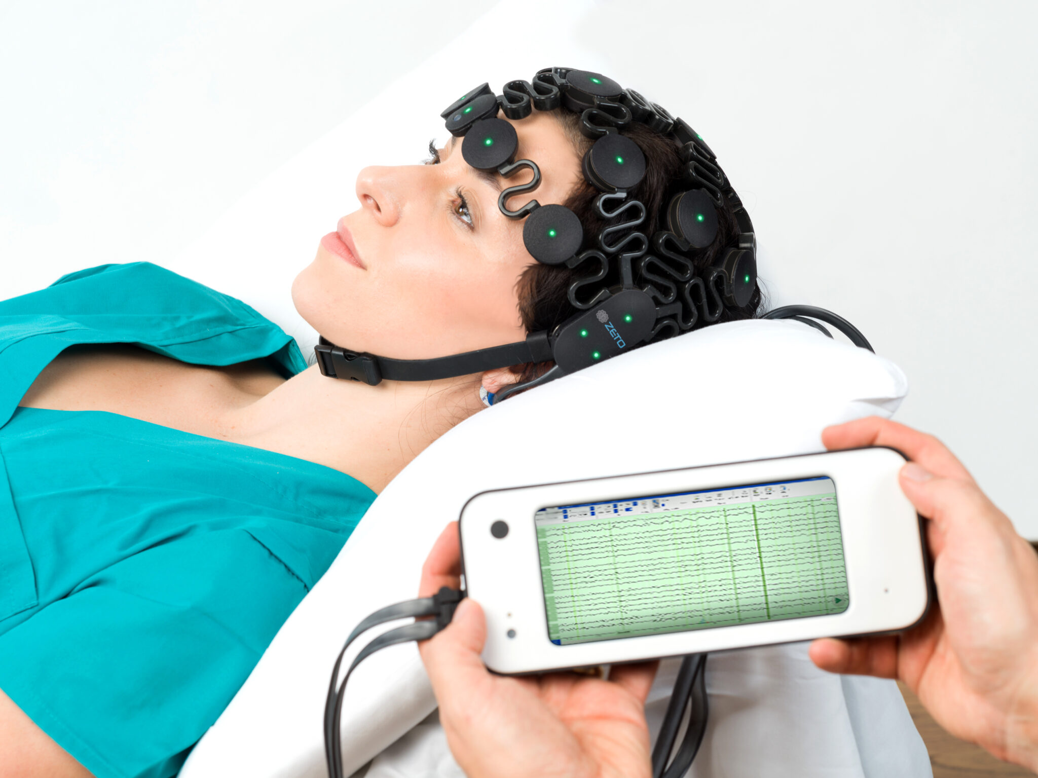 EEG After Cardiac Arrest: Neuroprognostication as a Vital Tool