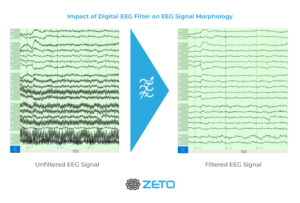 How Digital EEG Filters Impact EEG Signal Morphology | Zeto EEG