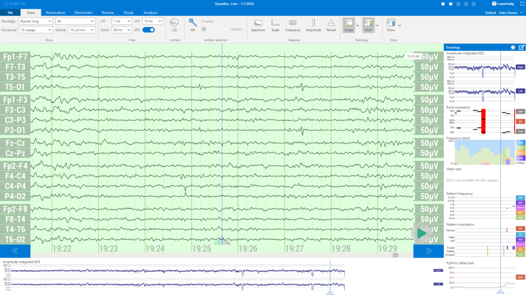 Zeto Offers Seizure Detection