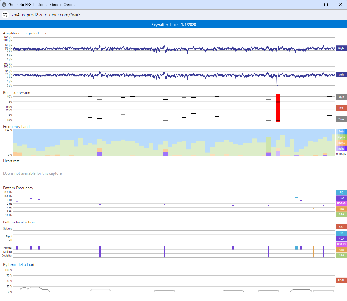 Zeto Offers Seizure Detection
